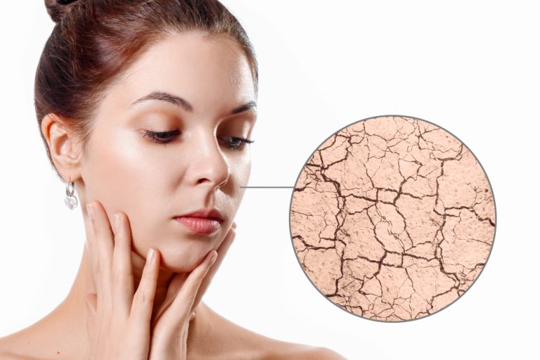 4 Chronic Conditions That Cause Dry, Flaky Skin | Specialists in ...