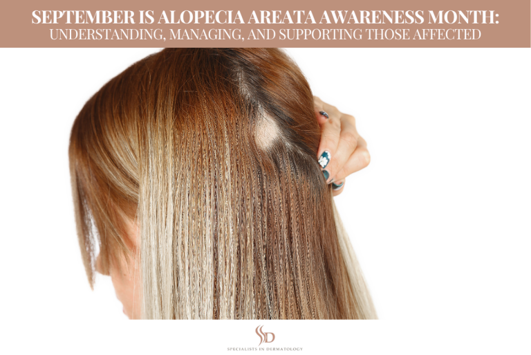 September is Alopecia Areata Awareness Month: Understanding, Managing ...